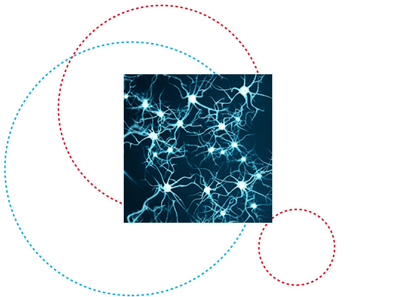 THE ROLE OF BRAIN BORDERS IN AD - LCSB - Université du Luxembourg I Uni.lu