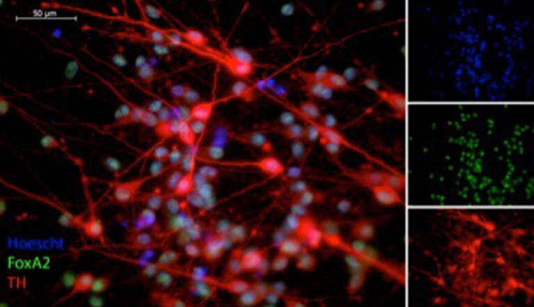 Translational Neuroscience group