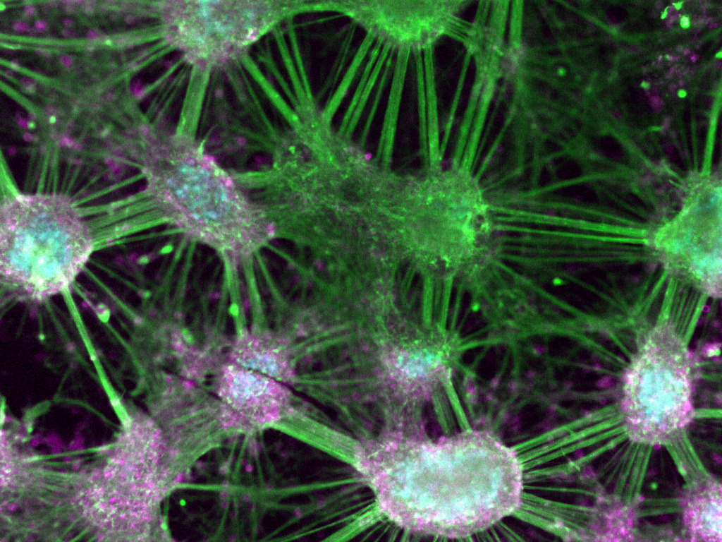 Molecular Disease Mechanisms - Research area I University of Luxembourg