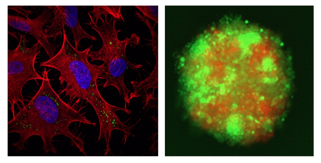 World Cancer Day: Tumour biology is a research focus at the University ...